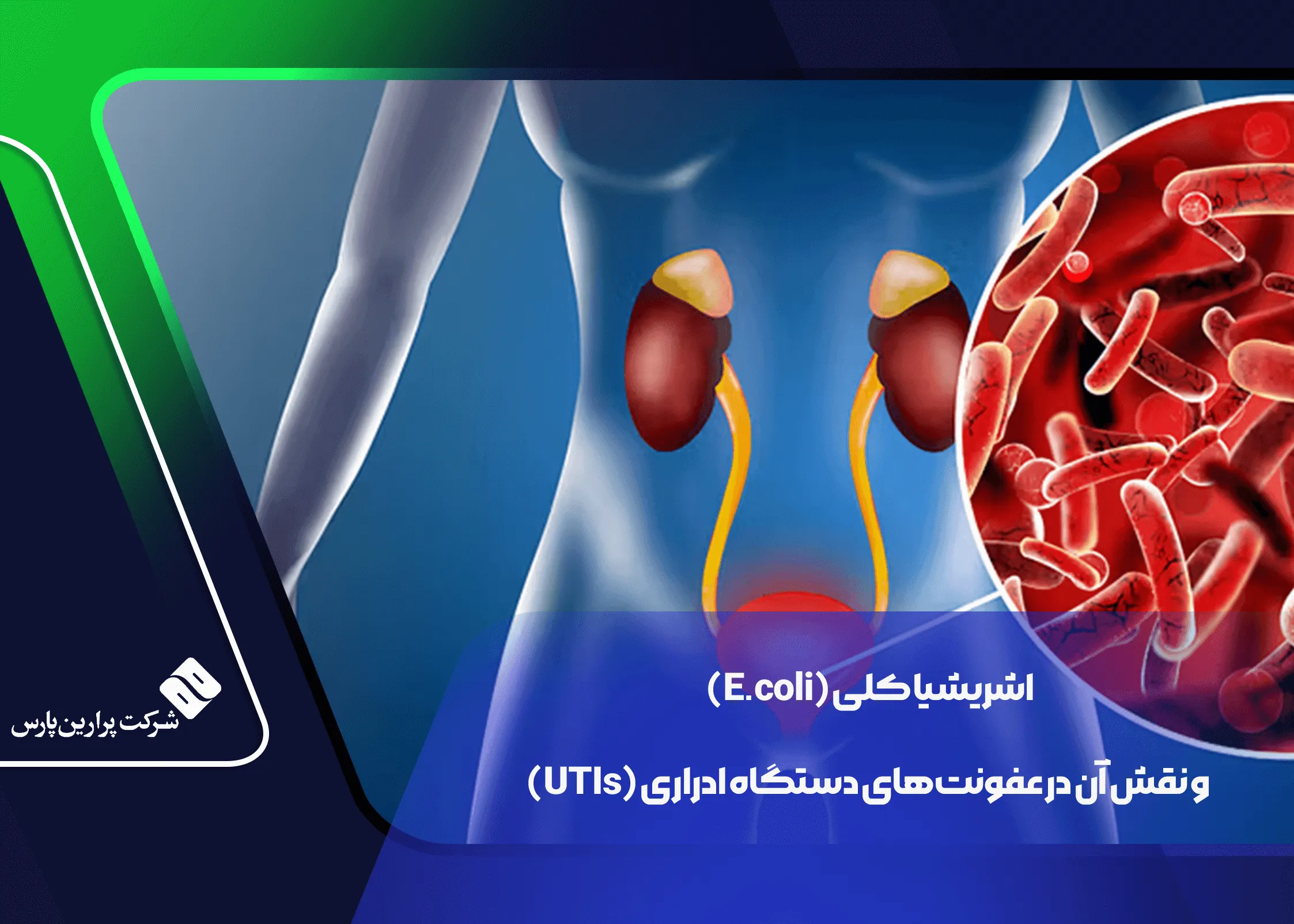 Escherichia coli (E. coli) and its Role in Urinary Tract Infections ...